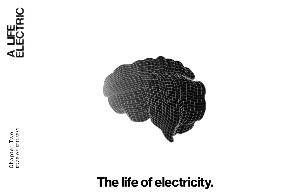 A Life Electric — Chapter 2, Edge of Epilepsy - The life of electricity